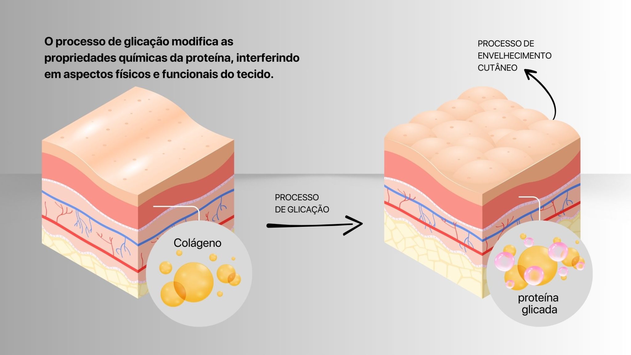 Glicação na Pele: O Que É, Como Tratar e Como Evitar